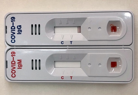 Γρήγορο τεστ για κορωνοϊό στο νοσοκομείο της Άρτας - ΤΑΧΥΔΡΟΜΟΣ ΑΡΤΑΣ